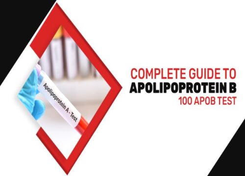 Complete Guide To Apolipoprotein B – 100 (Apob) Test