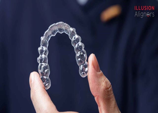 6 Problems that Illusion Aligners Corrects