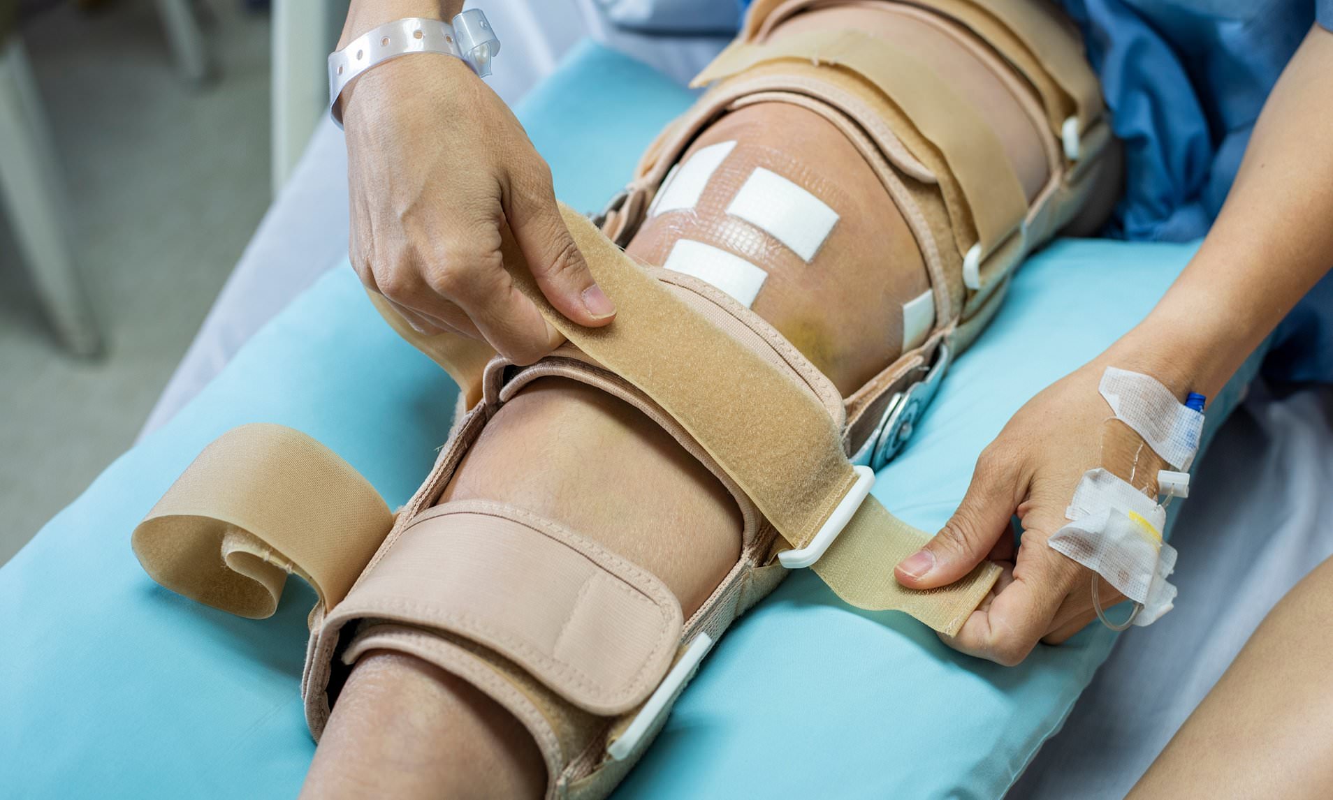 The Knee Ligament Recovery & Rehab Process