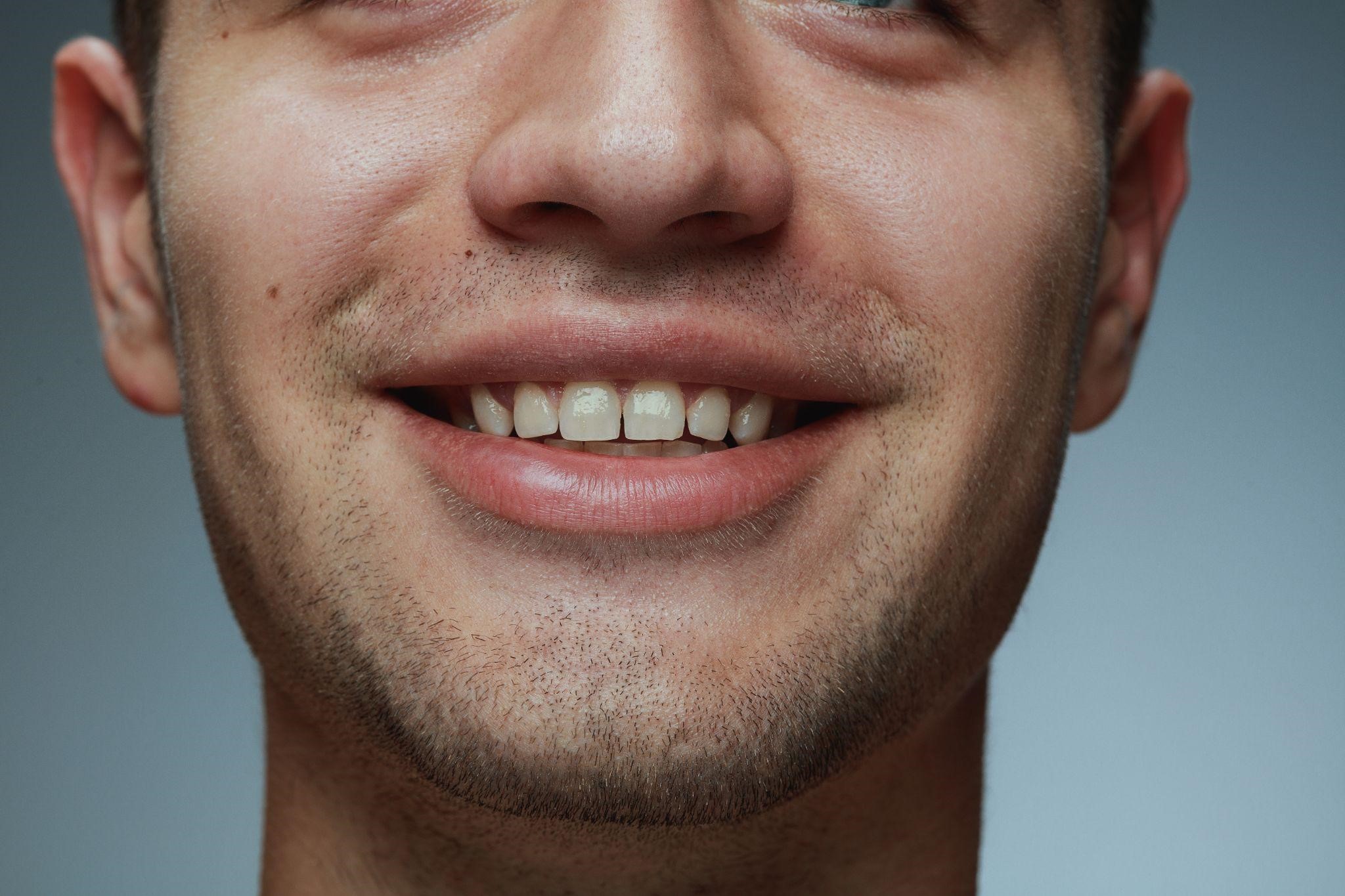 What Is Diastema? Gap Between the Teeth Explained