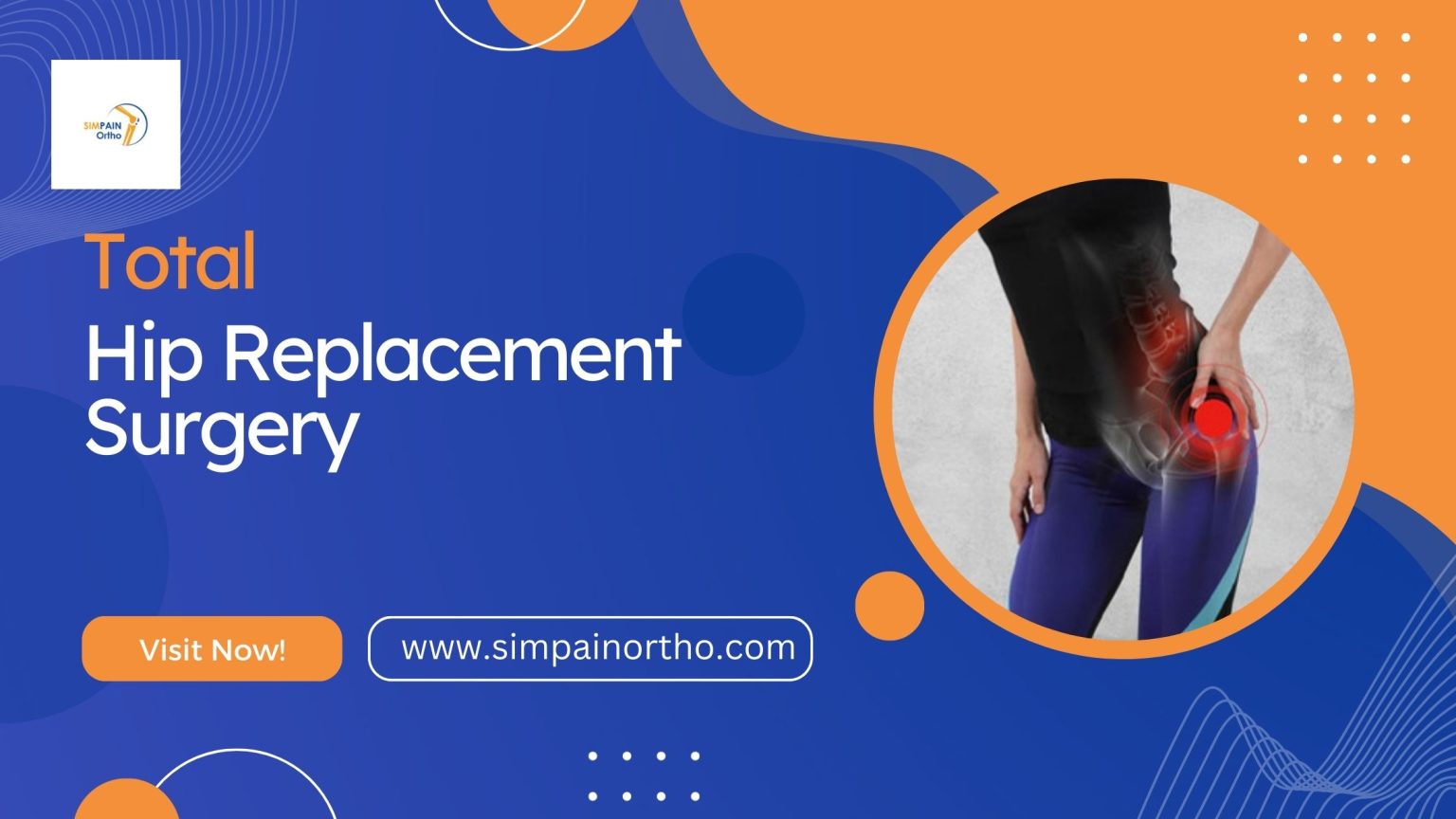 Total Hip Replacement Surgery: An Overview