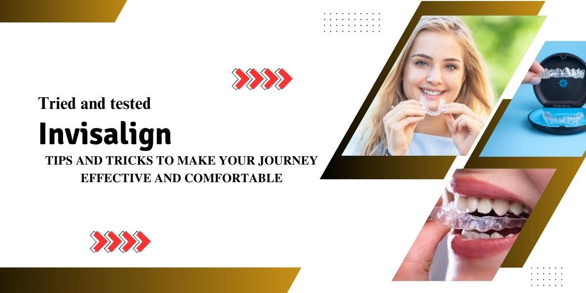 Tried & tested Invisalign tips & tricks to make your journey effective