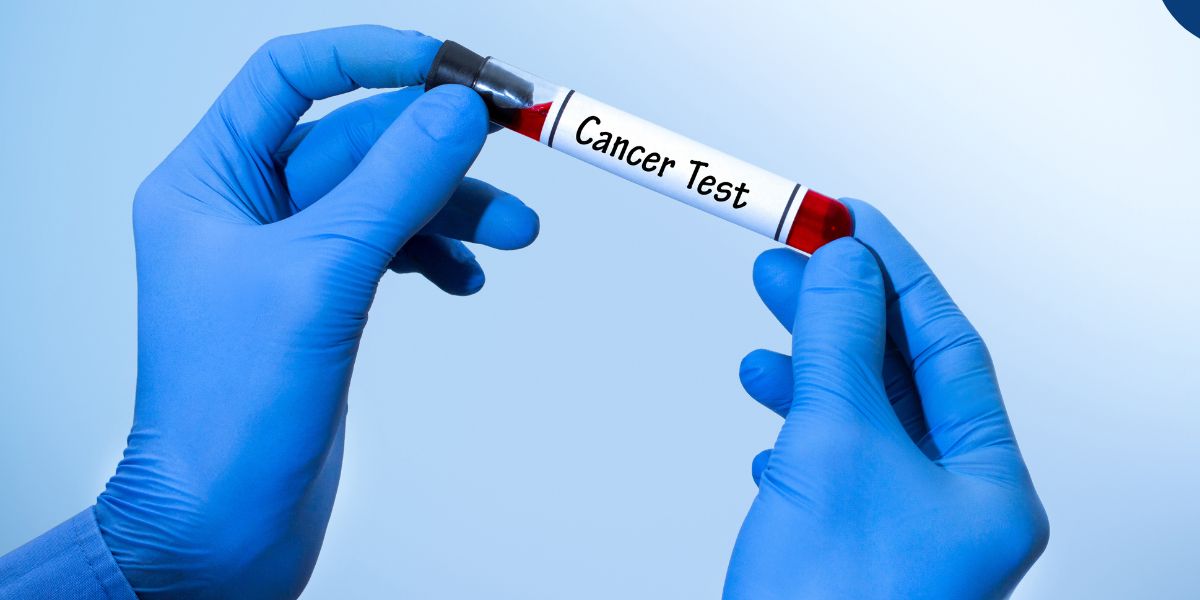 Blood Tests for Cancer Detection: Insights Explained!