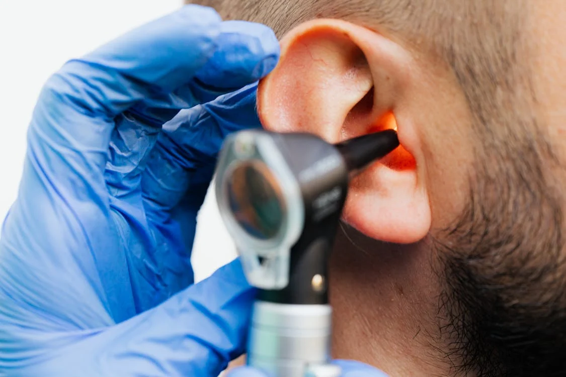 Cochlear Implant Surgery: A Step-by-Step Guide