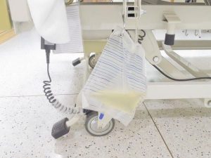 comprehensive guide different urine collection methods and types