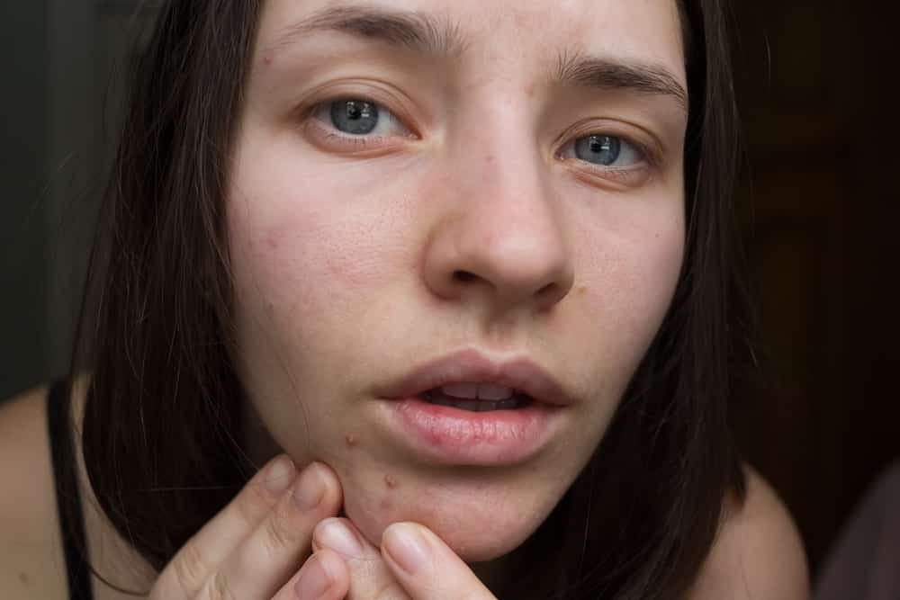 How Abu Dhabi's Endocrinologists and Dermatologists Can Assist with ...