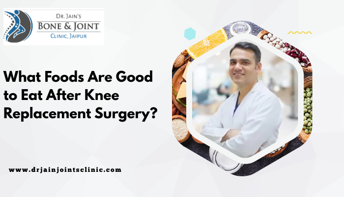 What Foods Are Good to Eat After Knee Replacement Surgery?