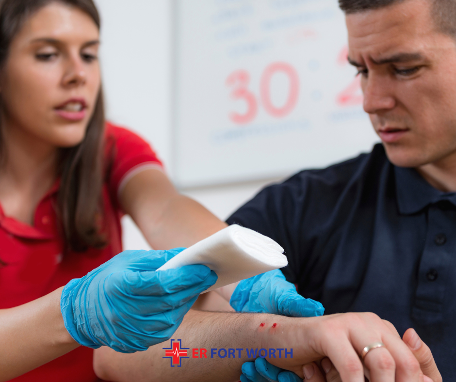 7 Powerful Minor Burn Treatment Tips & Emergency Care Guide