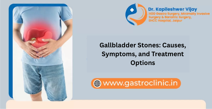 Gallbladder Stones: Symptoms, Causes & Treatment Methods