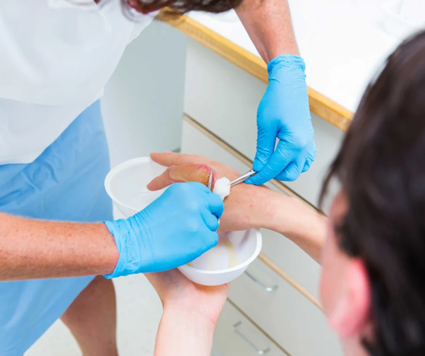 7 Best Treatments for Burns: Effective Treatment of Burns Today