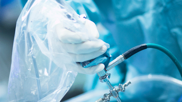 How Arthroscopic Rotator Cuff Repair Helps You Heal Faster